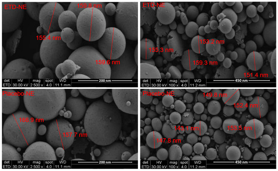 Nanoemulsions as a Promising Carrier for Topical Delivery of Etodolac ...