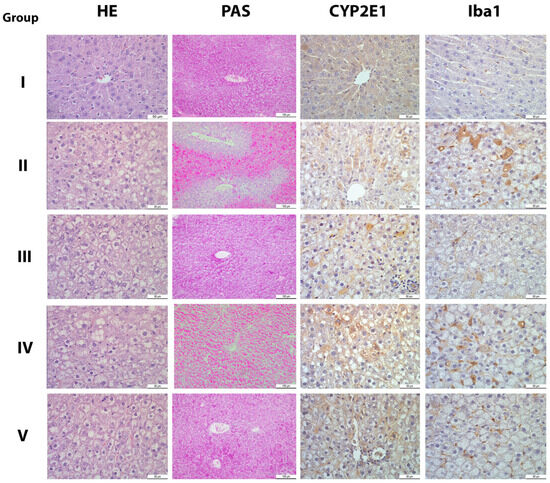 Carob Extract (Ceratonia siliqua L.): Effects on Dyslipidemia and ...