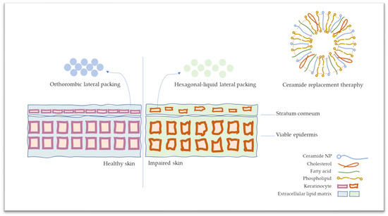 The Design and Optimization of Ceramide NP-Loaded Liposomes to Restore ...