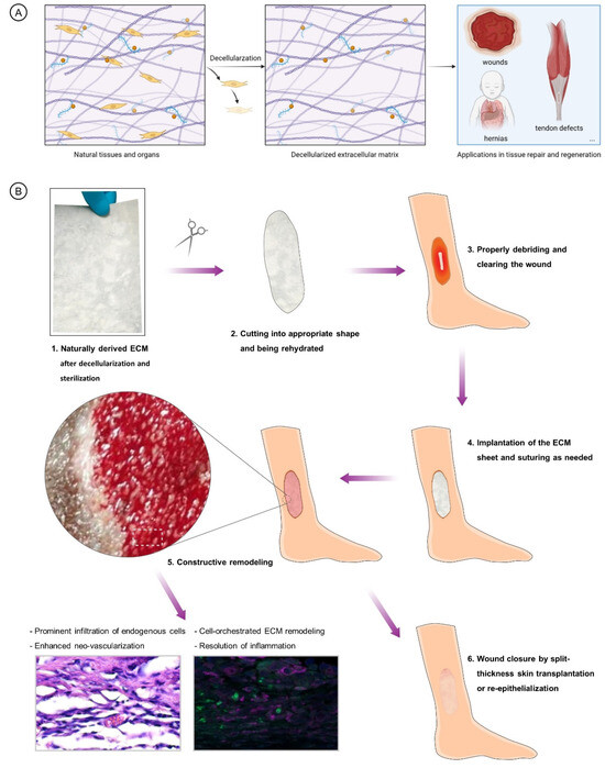 Extracellular Matrices as Bioactive Materials for In Situ Tissue ...