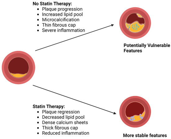 Potential Benefits and Risks Associated with the Use of Statins