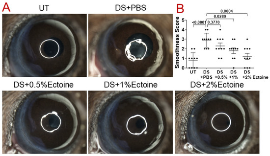 Ectoine, from a Natural Bacteria Protectant to a New Treatment of Dry ...