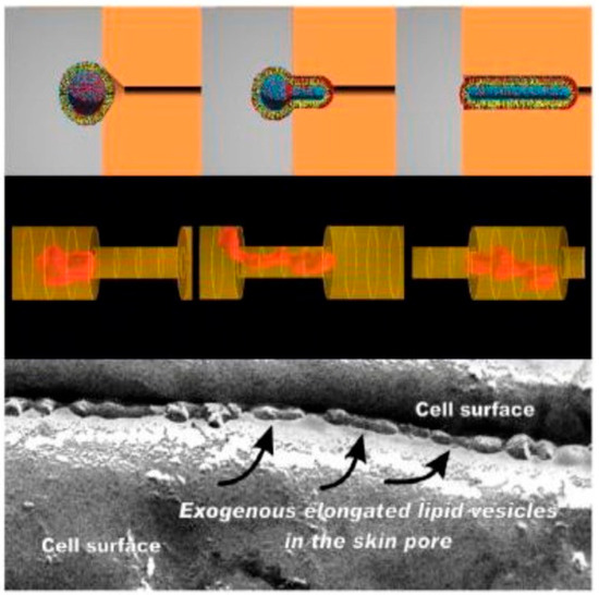 The Evolution of Emerging Nanovesicle Technologies for Enhanced ...