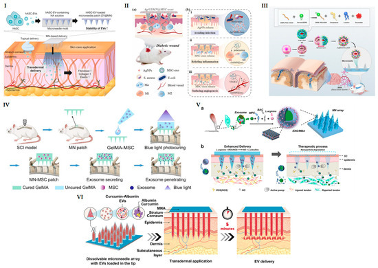Research Progress of Extracellular Vesicles-Loaded Microneedle Technology