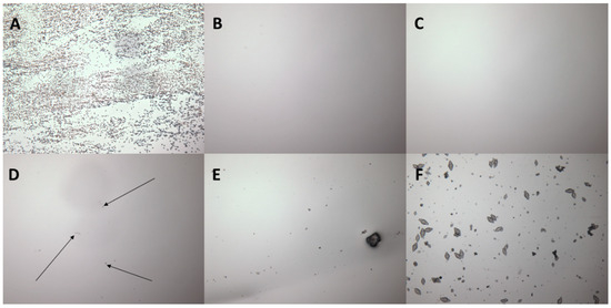 Enhanced Skin Permeation of 5-Fluorouracil through Drug-in-Adhesive ...