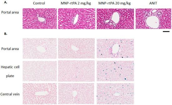 Targeted Thrombolysis with Magnetic Nanotherapeutics: A Translational ...