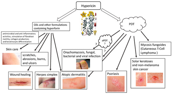 Cytotoxic and Immunomodulatory Effects of Hypericin as a ...