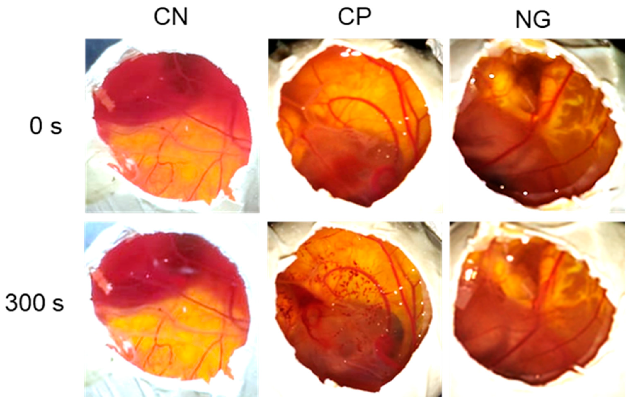 Protium spruceanum Extract Enhances Mupirocin Activity When Combined ...