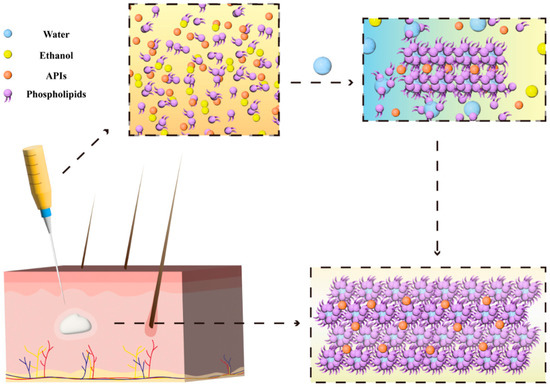 The Advances in Phospholipids-Based Phase Separation Gels for the ...