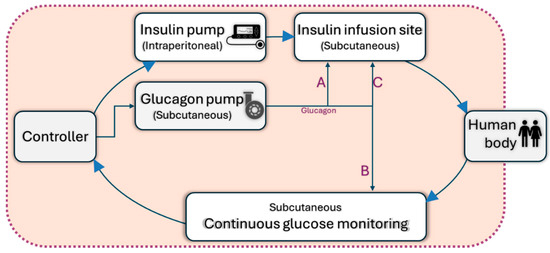 Advancements in Insulin Pumps: A Comprehensive Exploration of Insulin ...