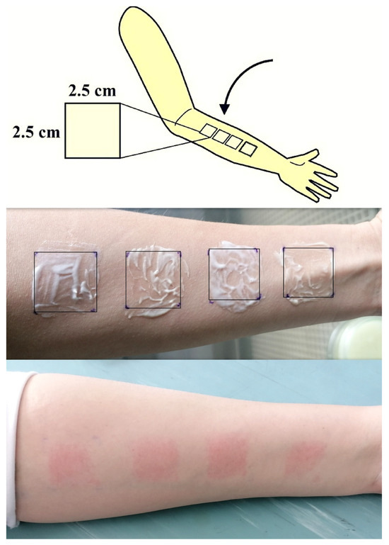 Liposomal Encapsulation of Ascorbyl Palmitate: Influence on Skin ...