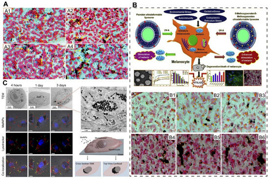 Nanocarrier-Based Transdermal Drug Delivery Systems for Dermatological Therapy