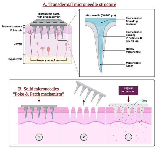 Revolutionizing Eye Care: Exploring the Potential of Microneedle Drug ...