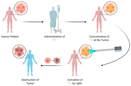 Enhancing Cancer Treatment Through Combined Approaches: Photodynamic ...