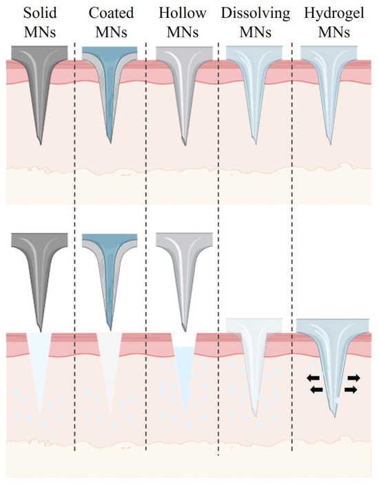 Advances in Research of Hydrogel Microneedle-Based Delivery Systems for ...