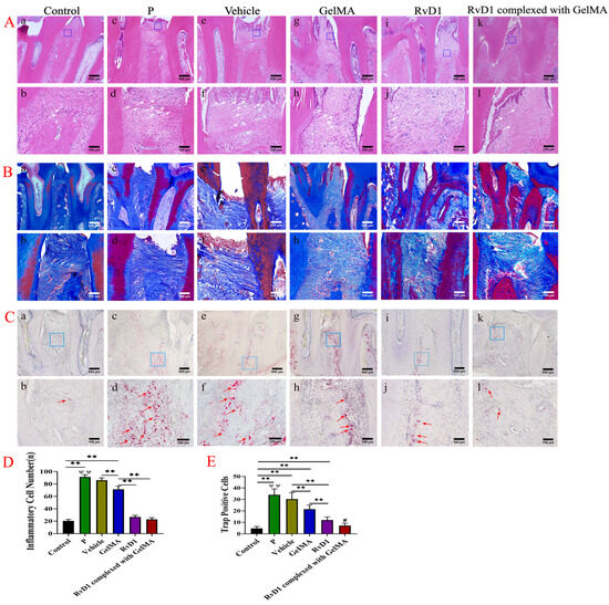 The Application of Resolvin D1-Loaded Gelatin Methacrylate in a Rat ...