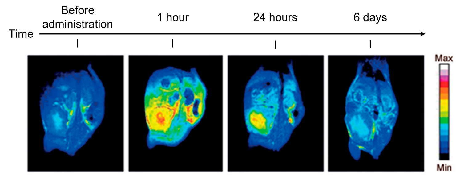 Navigating the Clinical Landscape of Liposomal Therapeutics in Cancer ...