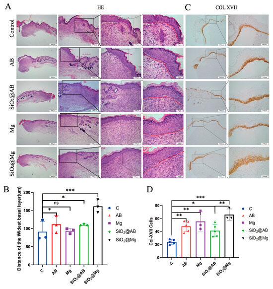 Hydrogen-Releasing Micromaterial Dressings: Promoting Wound Healing by ...