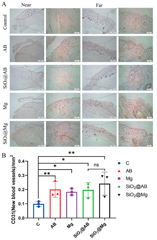 Hydrogen-Releasing Micromaterial Dressings: Promoting Wound Healing by ...