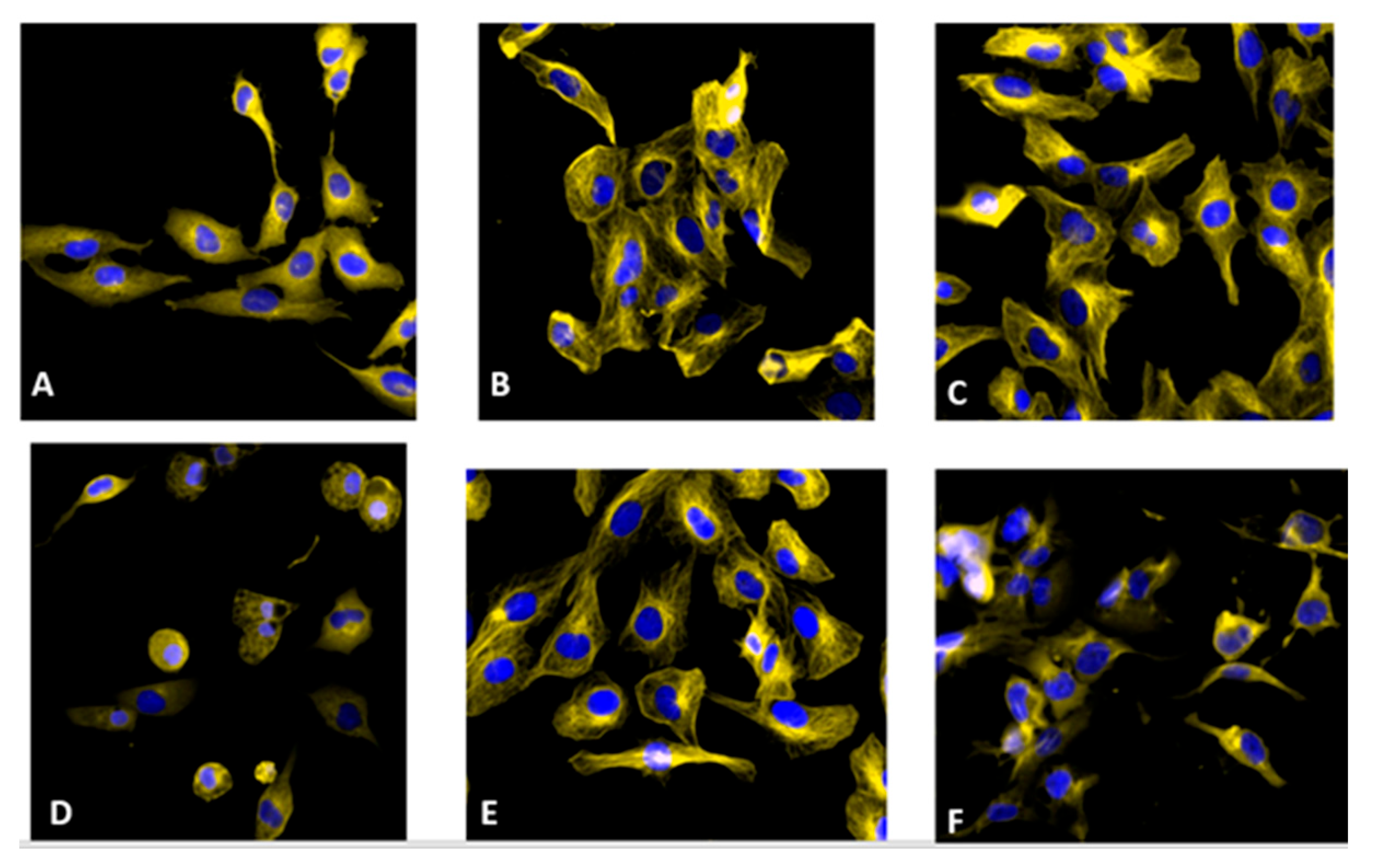 Insights into the Structural Patterns in Human Glioblastoma Cell Line ...