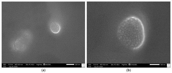 Emulsome-Based Nanocarrier System for Controlled 4-Phenylbutyric Acid ...
