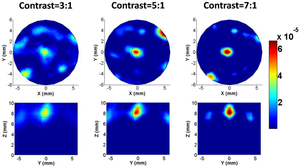FMTPen: A Miniaturized Handheld Fluorescence Molecular Tomography Probe ...