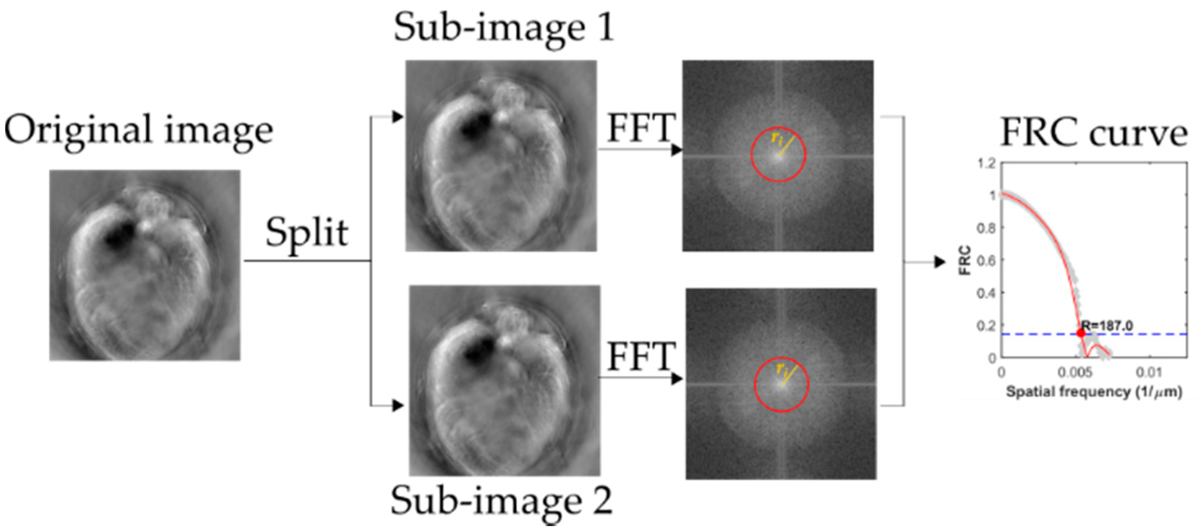 Photonics Free Full Text Image Deconvolution With Hybrid Reweighted Adaptive Total Variation