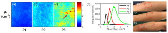 Photonics | Free Full-Text | Spatial-Frequency Domain Imaging: An ...