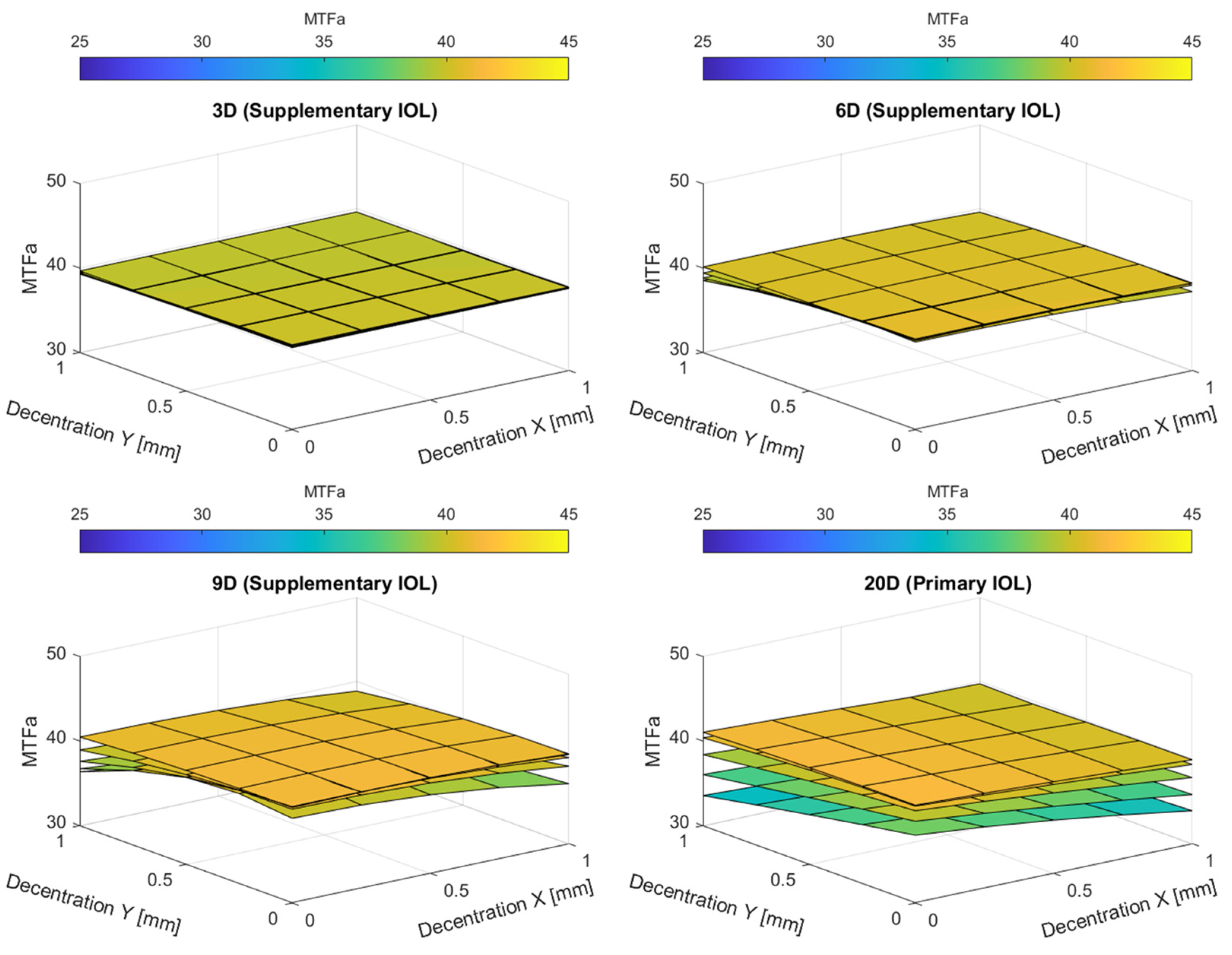 Simulations of Decentration and Tilt of a Supplementary Sulcus-Fixated ...