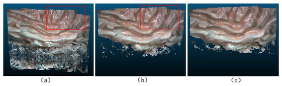 Three-Dimensional Stitching of Binocular Endoscopic Images Based on ...