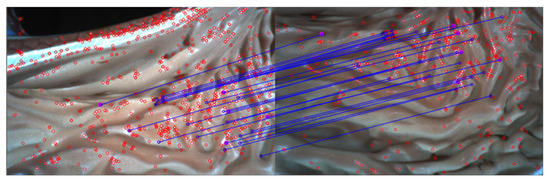 Three-Dimensional Stitching of Binocular Endoscopic Images Based on ...