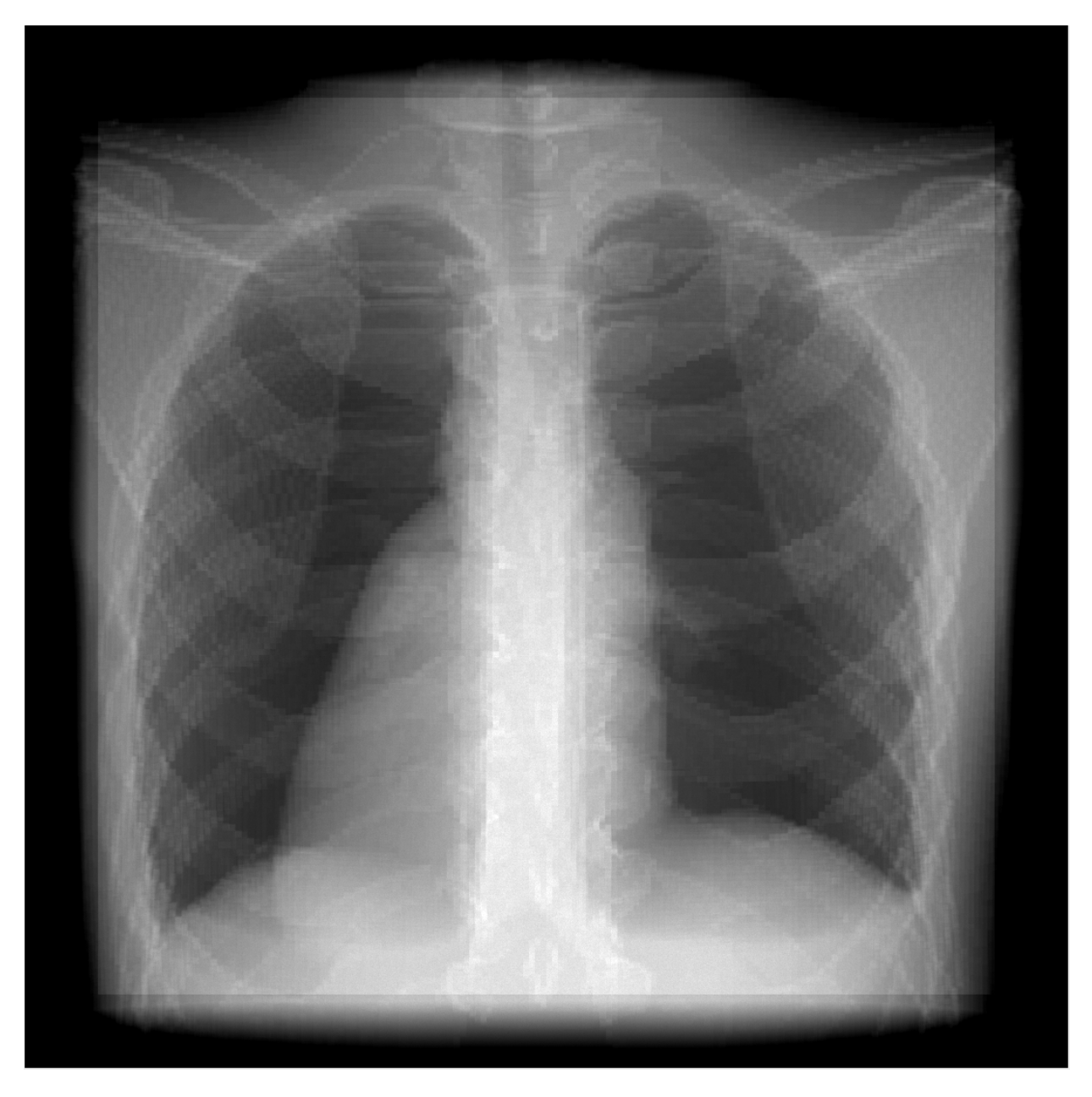Research on X-ray Fluorescence Enhanced Fluoroscopy Imaging Technology