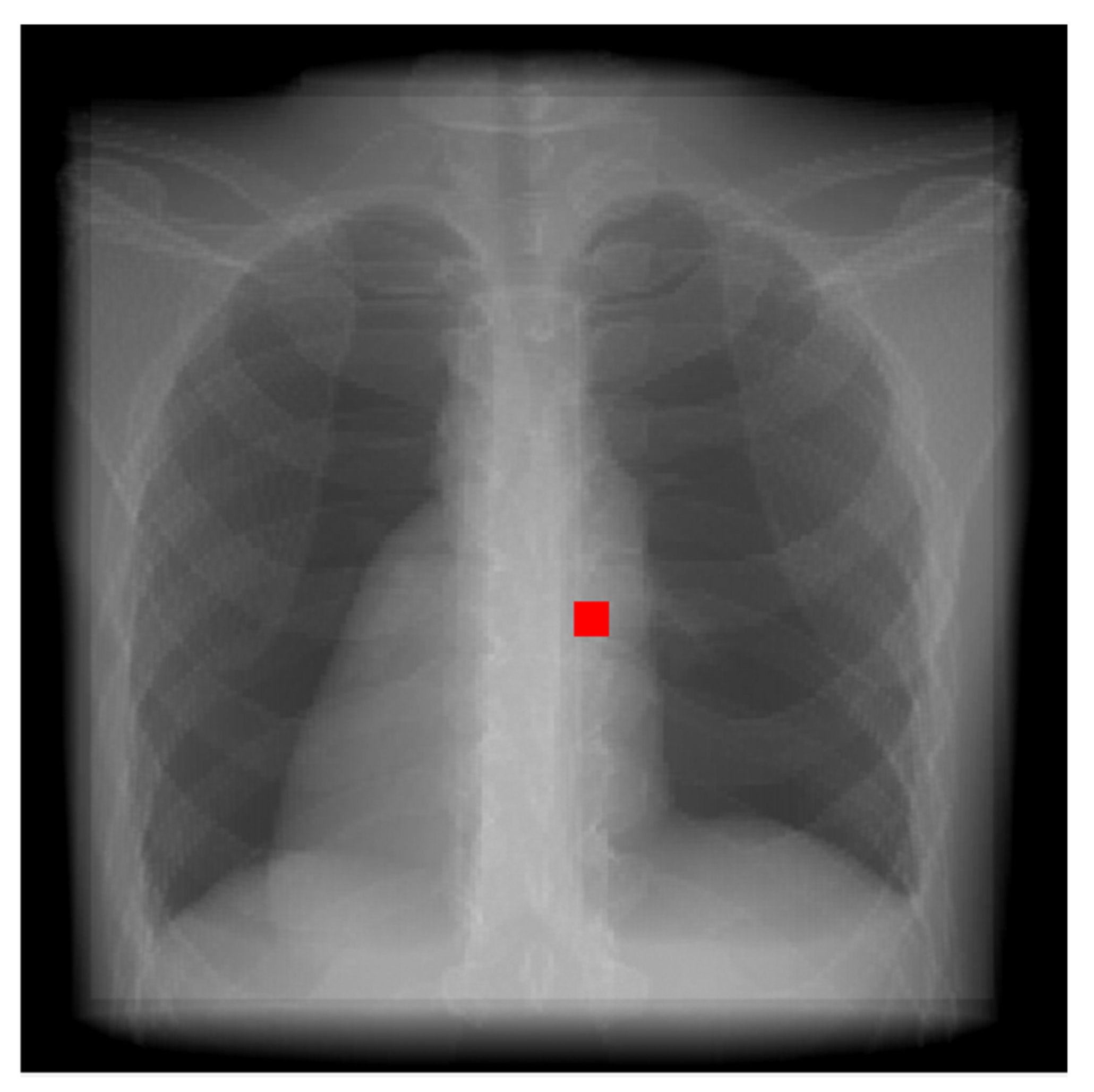 Research on X-ray Fluorescence Enhanced Fluoroscopy Imaging Technology