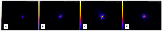 Retinal Optical Quality of Multifocal Refractive and Monofocal ...
