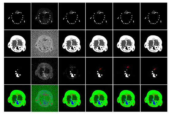 Tensor Dictionary Learning with an Enhanced Sparsity Constraint for Sparse-View Spectral CT ...