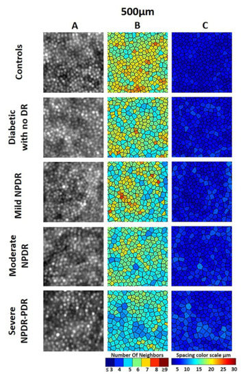 Application of Adaptive Optics in Ophthalmology