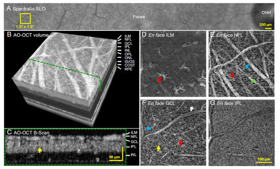 Application of Adaptive Optics in Ophthalmology