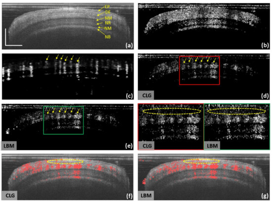 Endoscopic OCT Angiography Using Clinical Proximal-End Scanning Catheters