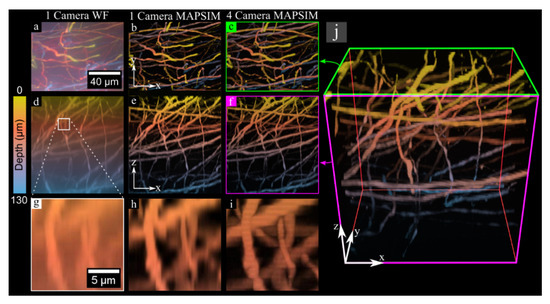 Flexible Multiplane Structured Illumination Microscope with a Four-Camera Detector