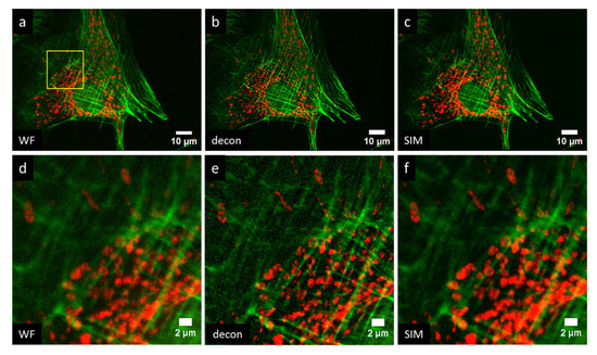 Flexible Multiplane Structured Illumination Microscope with a Four-Camera Detector
