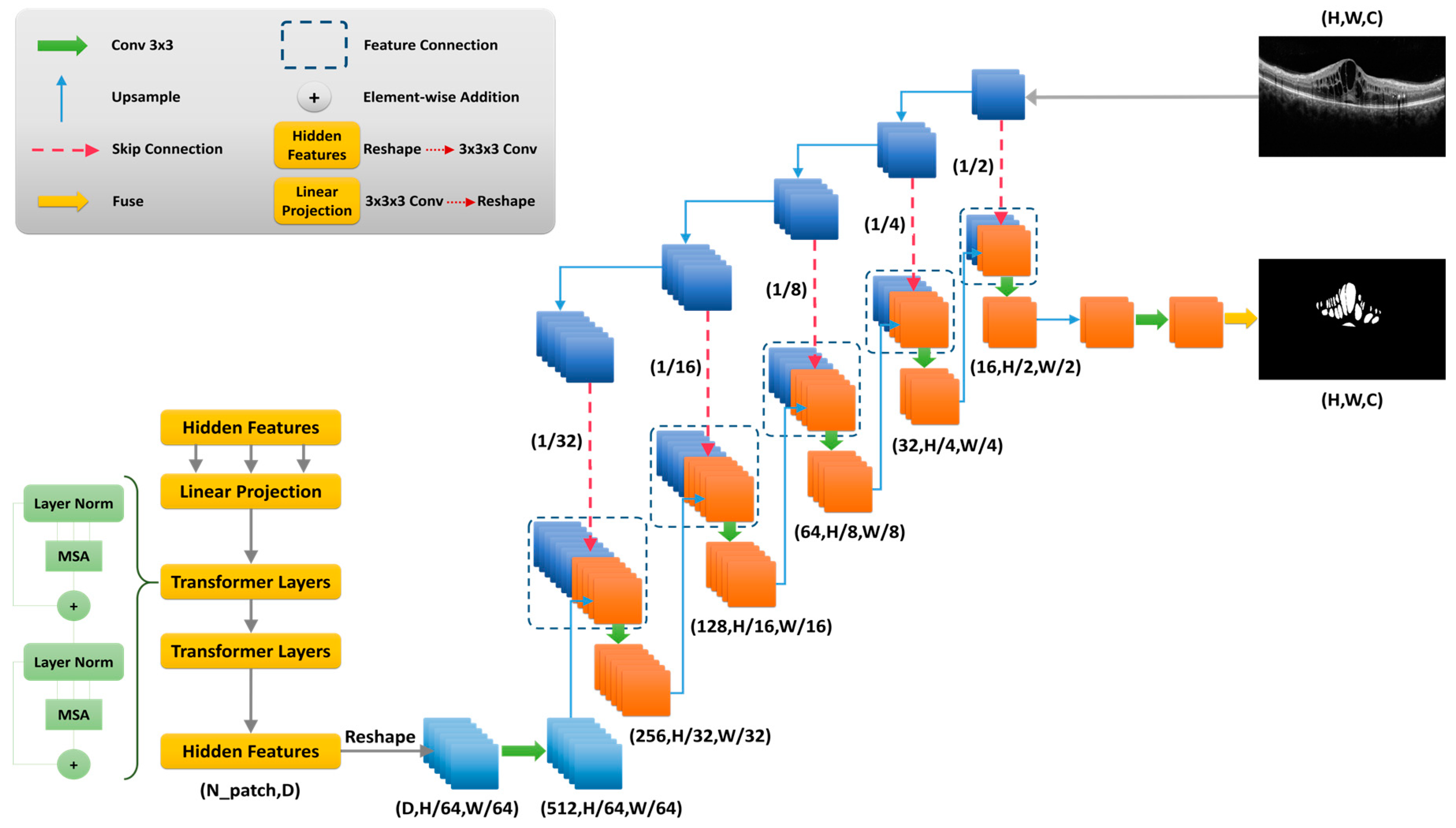 Dual-Tree Complex Wavelet Input Transform for Cyst Segmentation in OCT Images Based on a Deep ...