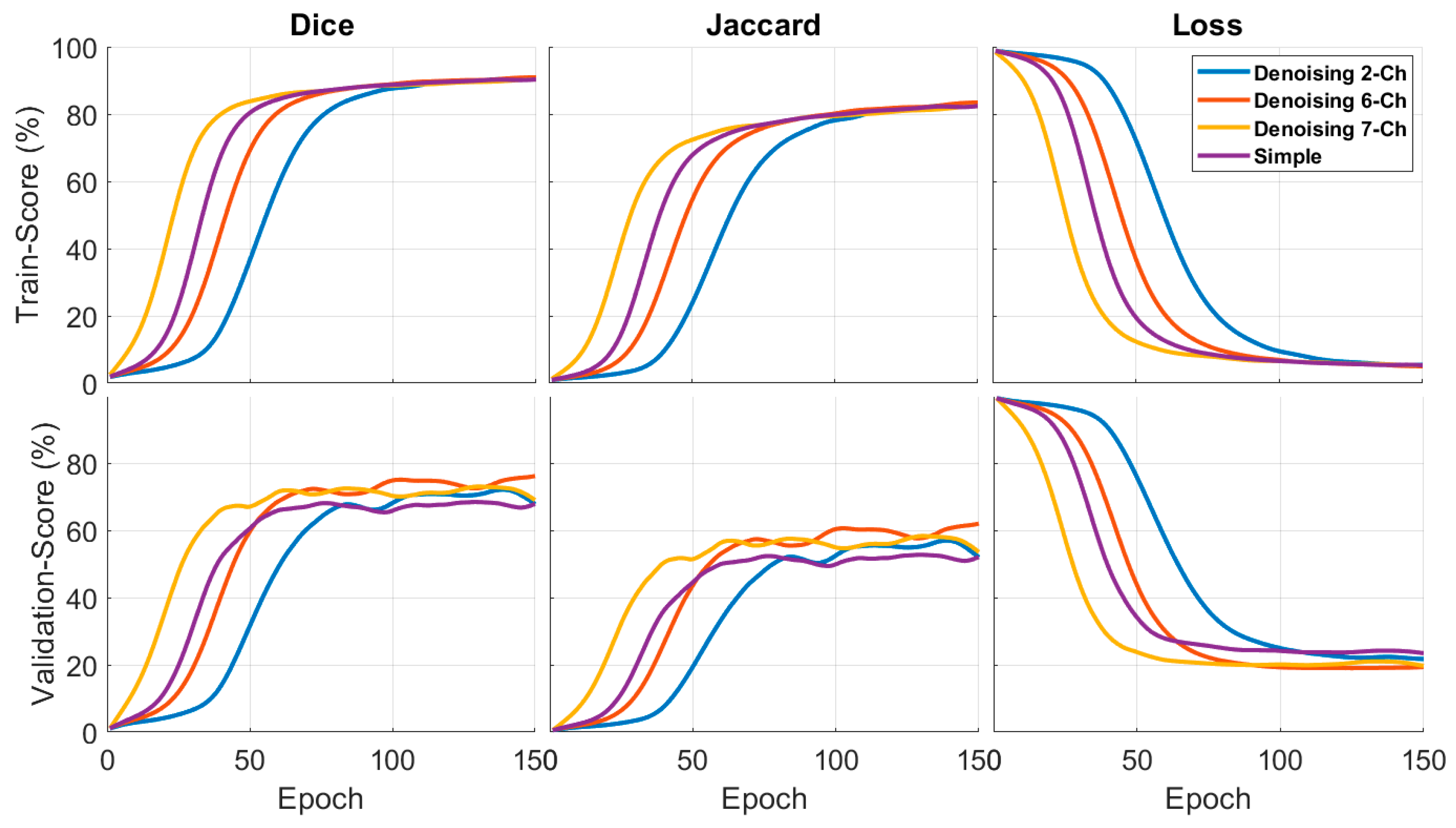 Dual-Tree Complex Wavelet Input Transform for Cyst Segmentation in OCT Images Based on a Deep ...