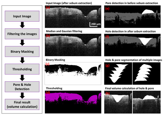 Photonics | Free Full-Text | A Case Report on Skin Sebum Extraction ...