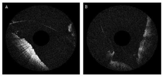Extracting Morphological and Sub-Resolution Features from Optical ...