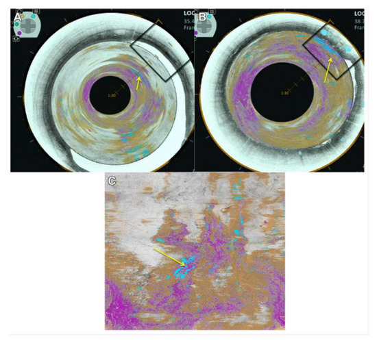 Extracting Morphological and Sub-Resolution Features from Optical ...