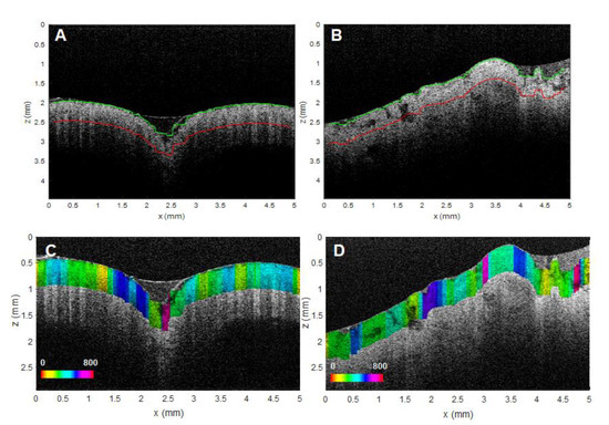 Extracting Morphological and Sub-Resolution Features from Optical Coherence Tomography Images, a ...