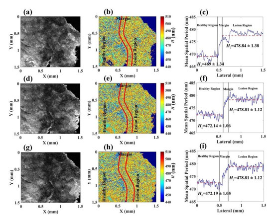 Extracting Morphological and Sub-Resolution Features from Optical Coherence Tomography Images, a ...