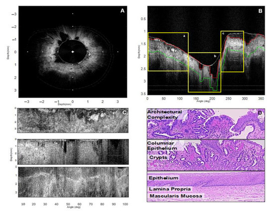 Extracting Morphological and Sub-Resolution Features from Optical Coherence Tomography Images, a ...