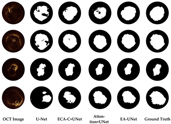 EA-UNet Based Segmentation Method for OCT Image of Uterine Cavity