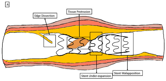 Current Applications and New Perspectives in Optical Coherence ...